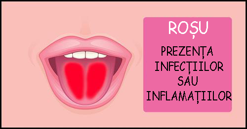 10 lucruri despre sănătate pe care limba ta le dezvăluie – Wawlist