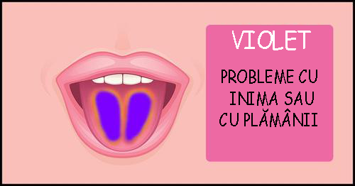 10 lucruri despre sănătate pe care limba ta le dezvăluie – Wawlist