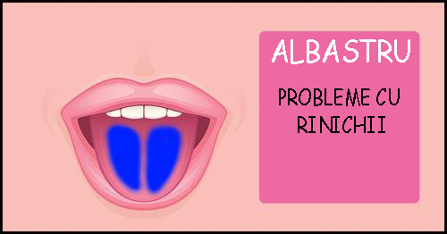 10 lucruri despre sănătate pe care limba ta le dezvăluie – Wawlist