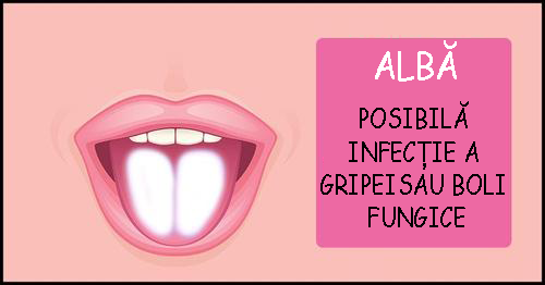 10 lucruri despre sănătate pe care limba ta le dezvăluie – Wawlist