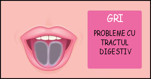 10 lucruri despre sănătate pe care limba ta le dezvăluie – Wawlist