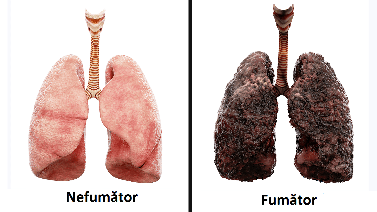 O asistentă explică ce se întâmplă cu plămânii tăi dacă fumezi în ...