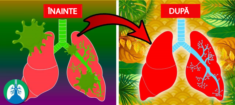 5 plante eficiente cunoscute care curăța plămânii și sinusurile – Wawlist