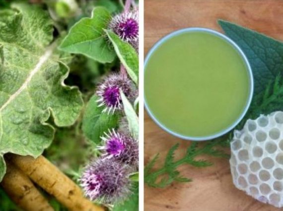 Crema naturală de brusture, eficientă în dureri lombare, spondiloză ...